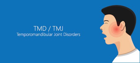 Trigger Point Injections for TMJ in West Orange NJ